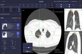 흉부 CT AI™, 일본 보험급여 대상 인정